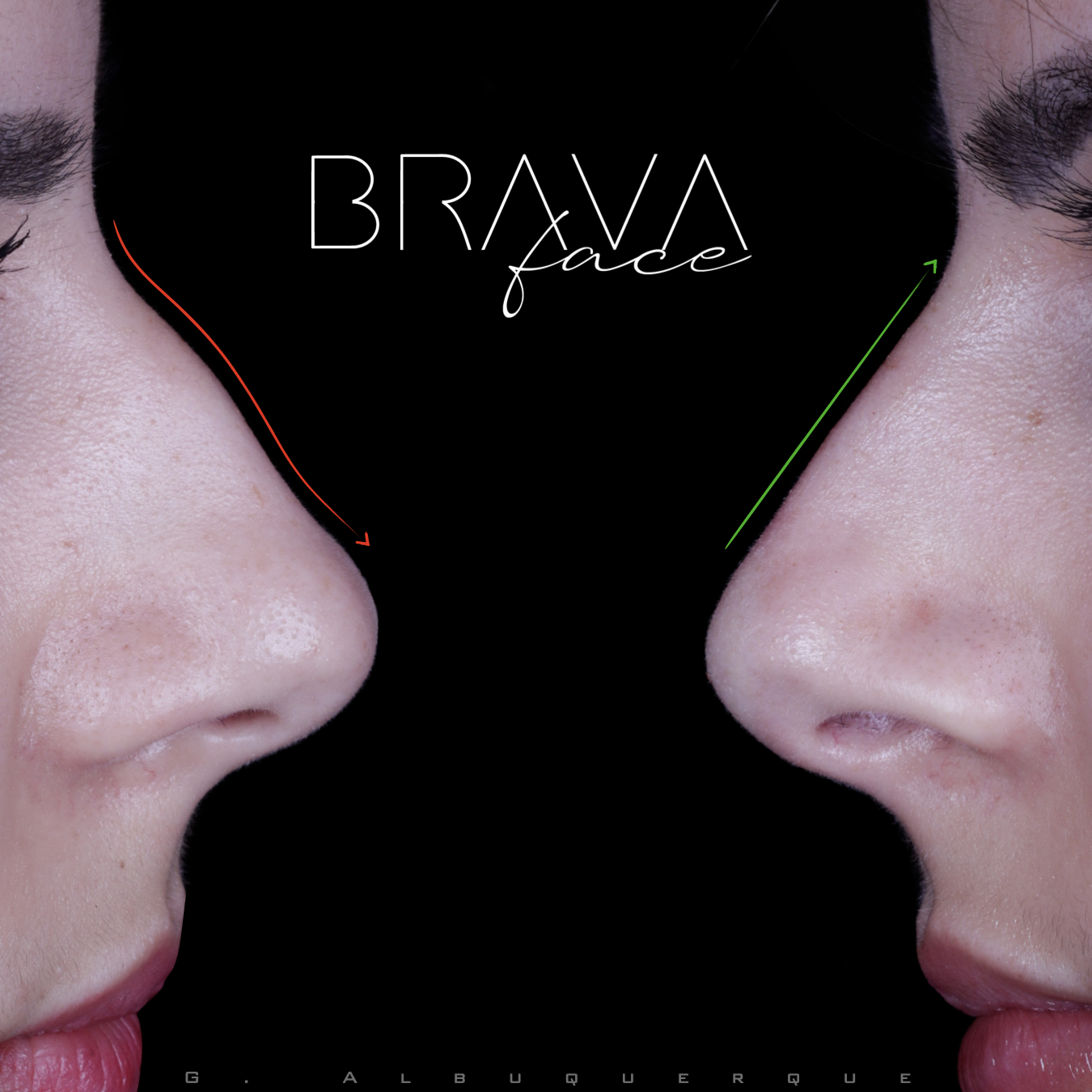 Home - Brava Face